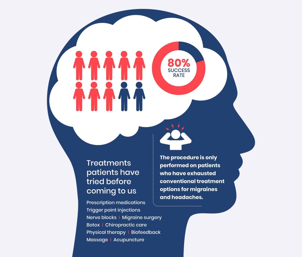 The Procedure | Headache and Migraine Relief | US Migraine